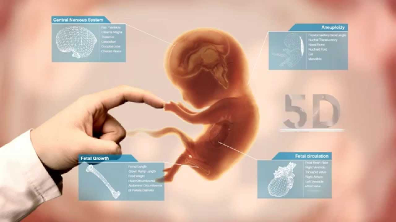5d Ultrasound In South Delhi In 5d Ultrasound The 3d Image Generated By 5d Ultrasound In South Delhi In 5d Ultrasound The 3d Image Generated By