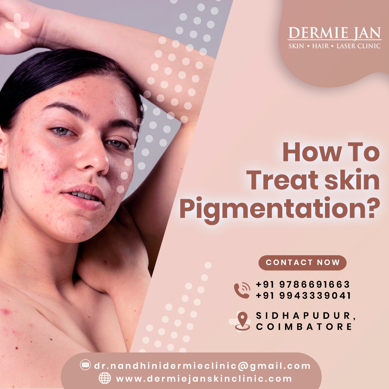 How to treat skin pigmentation/ what is skin pigme