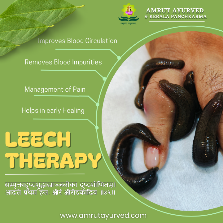 Leech Therapy For Acne